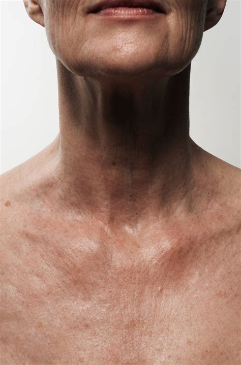 Pp Skin Type What Are Its Characteristics