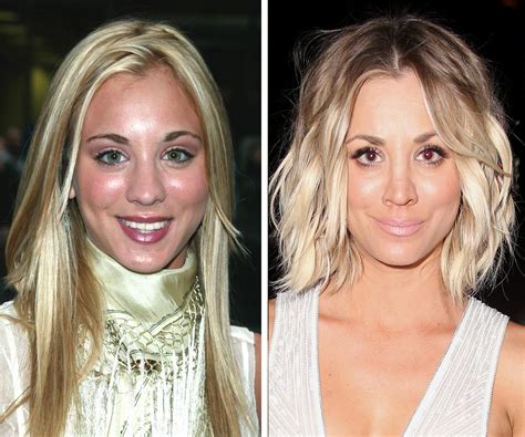 Kaley Cuoco Nose Job Before And After