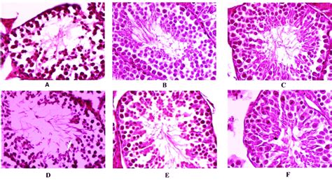 Results Of Radioprotective Effect Of Selenium Or Zinc On Mice