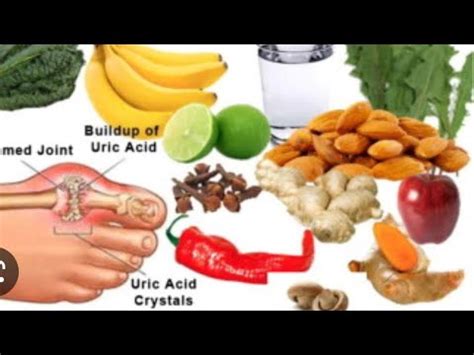 Natural Ways To Reduce Uric Acid In The Body Uric Acid Ka Ilaj Home