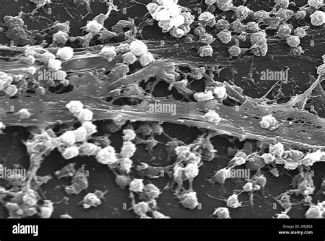 Staphylococcus Aureus Biofilm