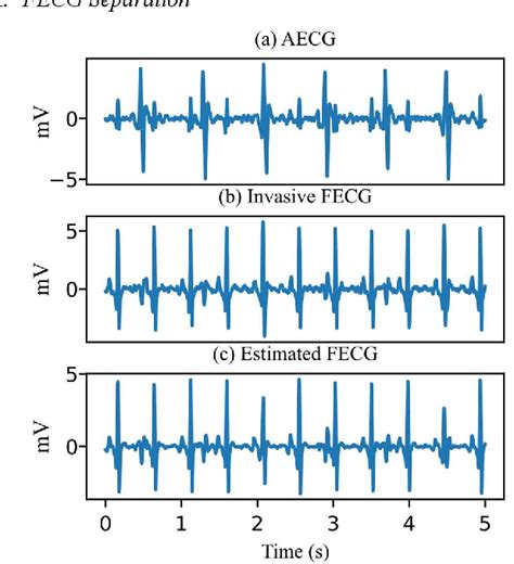 Figure 1 From Res Unet Based Fetal Electrocardiogram Extraction Via