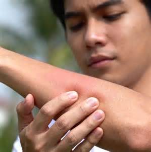 长期炎症会“唤醒”癌细胞？这些“慢性炎症”的表现速来自查→癌症omega 身体