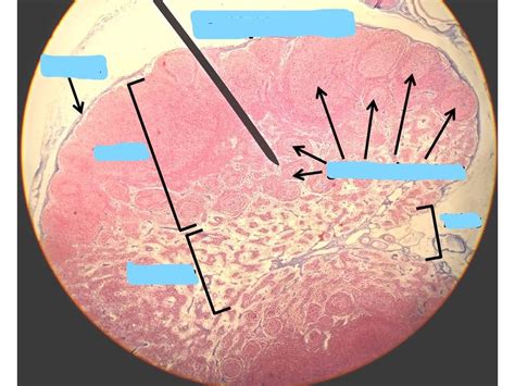 Lymph Node Diagram Quizlet
