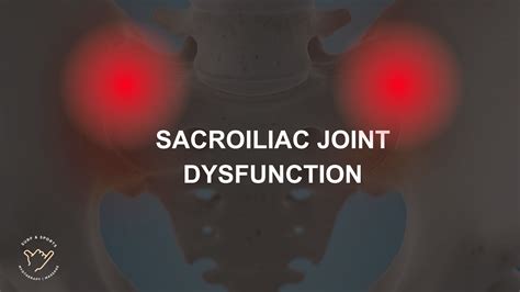 Causes And Relief For Sacroiliac Joint Dysfunction Surf And Sports Myotherapy