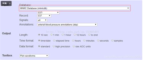 Mimic数据库中数据的下载以及matlab读取mimic数据库怎么在matlab中使用 Csdn博客
