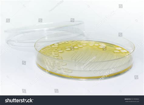 Colony Bacteria Bacillus Species Colony On ภาพสต็อก 551959063