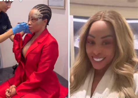 Natural Beauty Khanyi Mbau Before Surgery Bleaching [photos]
