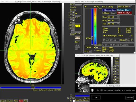 121 Self Guided Demo Scripts — Afni Suma And Fatcat V25207