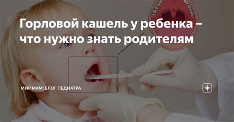 Горловой кашель у ребенка – что нужно знать родителям | Мир мам: блог ...
