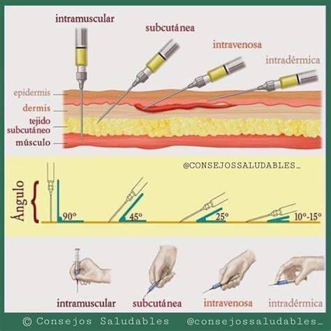 Tipos De Inyecciones ¿quieres Saber Más Síguenos👉🏼 Pideturemedio Es
