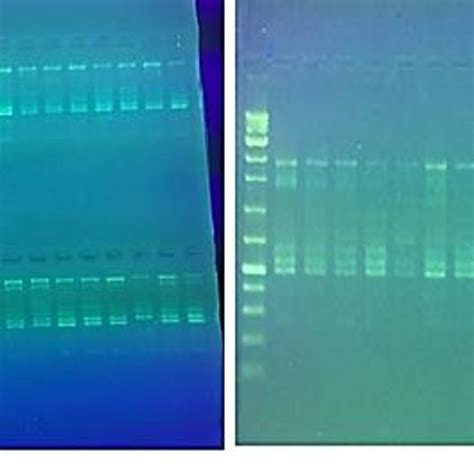 Gel Electrophoresis Of Genomic Dna Extraction From Plant 1 Agarose