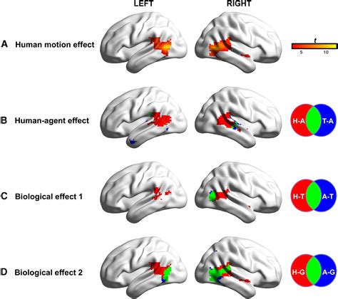 Distinct Regions Of Right Temporal Cortex Are Associated With Biological And Human Agent Motion