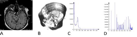 a slice of a mra dataset a a volume rendering that shows the