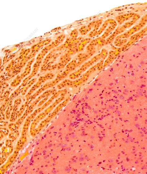 Choroid Plexus Light Micrograph Stock Image C036 8256 Science Photo Library