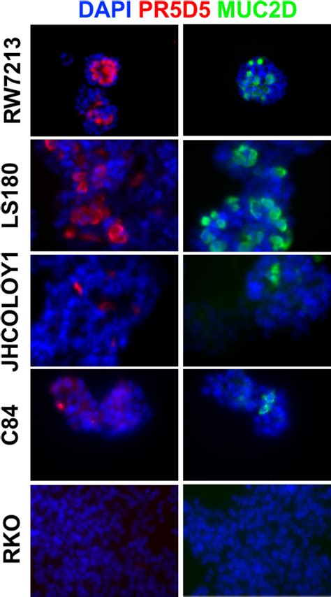 Figure 11 From Goblet Cell Differentiation In Human Colorectal Cancer