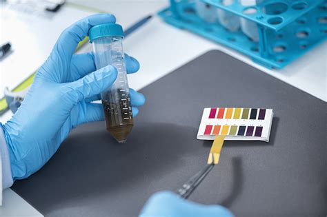 Why Is Microbiological Sampling Important