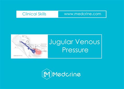 Jugular Venous Pressure Examination And Interpretation Medcrine