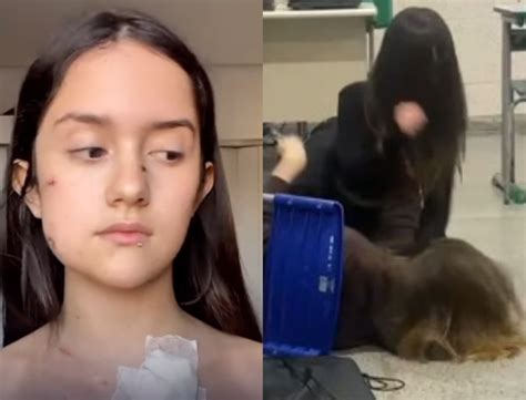 Veja VÍdeo Menina Que Levou Tesourada Na Escola Revela Motivo Da Briga