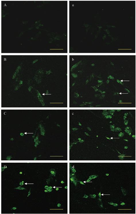Identification Of α Synuclein Aggregates By Thioflavine S Staining In Download Scientific