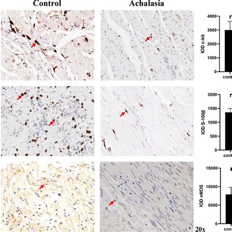 Immunohistochemistry And Quantification Of Macrophages In Les Tissue Download Scientific