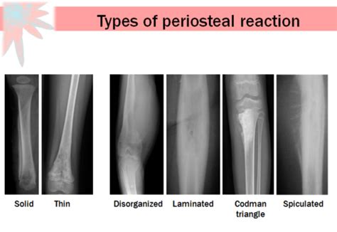 Di5 Musculoskeletal Radiography Flashcards Quizlet