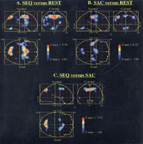 Brain Areas Activated During The Reproduction Of A Previously Learned