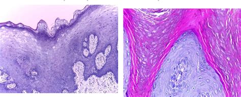 Figure 2 From Early Detection And Diagnosis Of Oral Cancer Using Deep