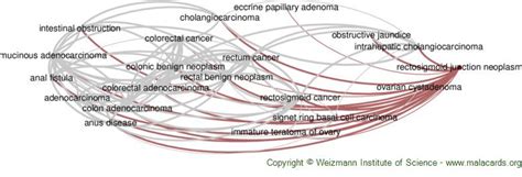 Rectosigmoid Junction Neoplasm Disease Malacards Research Articles Drugs Genes Clinical Trials