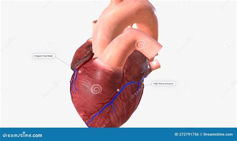Beta Blockers For Treating Cardiovascular Conditions Royalty Free Stock