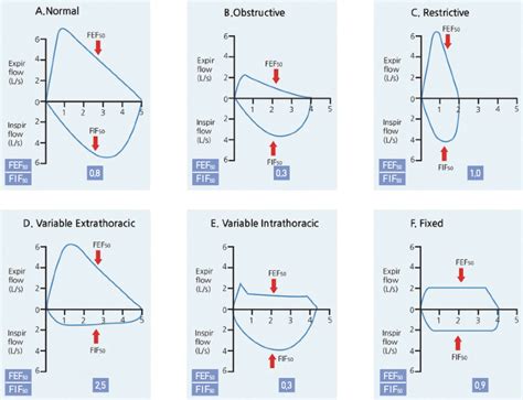 폐기능검사 Metamedic