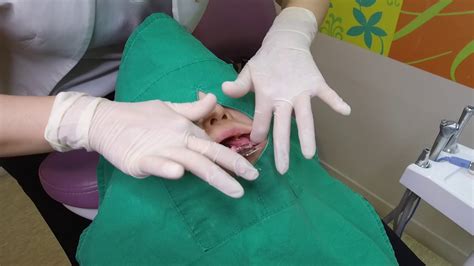 치아교정 정밀진단 준비과정 Youtube