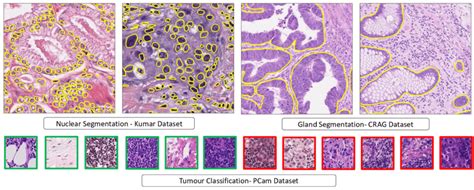 Image Regions From The Three Datasets For Nuclear Segmentation Gland Download Scientific