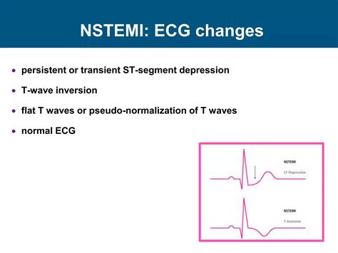 Ecg Interpretation Nstemi Pptx