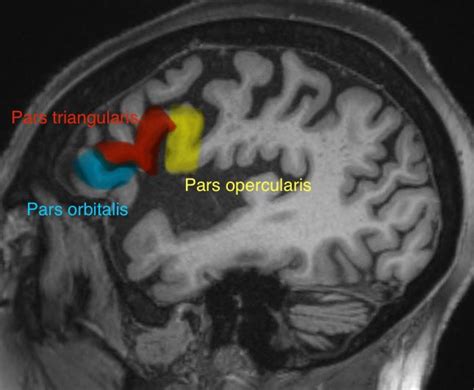 🔷frontal Expressive Language Area Broca Area Corresponds To The