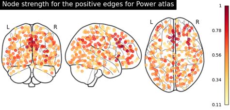 7 Plotting Brain Images Nilearn