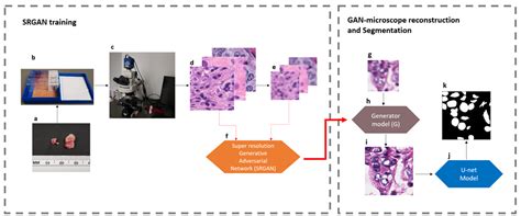 Github Aniwatjsuper High Resolution And Segmentation Deep Learning For Cancer Histopathology