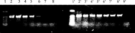 Method For Detecting Plant Pathogenic Bacteria Sensitivity By Improving Pcr Technology Eureka