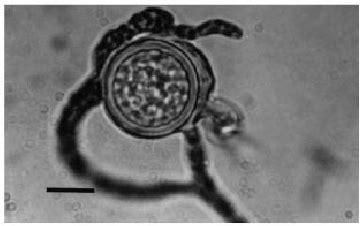 Aplerotic Oospore With Attached Antheridium Of Pythium Coloratum Download Scientific Diagram