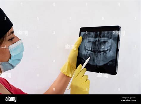 He X Ray Is Of An Old Young Male Female And Explains The Procedure