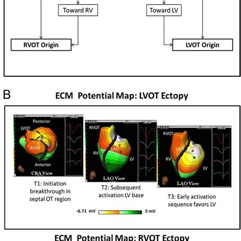 A ECM Method Of Localization Of Ectopy Origin B ECM Potential Maps Download Scientific