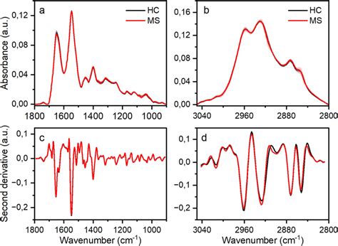 Atr Ftir Average Spectra Recorded At 25 °c Of Plasma Samples From 40 Download Scientific