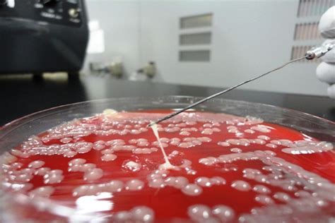 استرینگ تست String Test برای شناسایی ویبریو‌کلرا Vibrio Cholerae