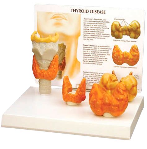 Thyroid Gland Model Thyroid Gland Glands
