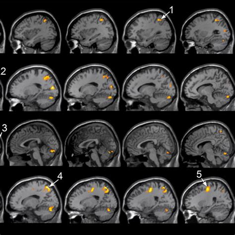 Differences In Task Based Neural Activity At Decision Points Between Download Scientific