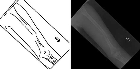 A Diagram Of An X Ray Left And A Synthetic X Ray Generated From That