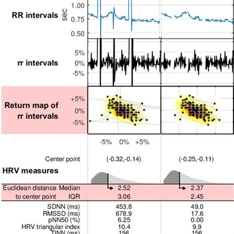 Top RR Intervals In Seconds And Corresponding Relative Intervals In Download Scientific