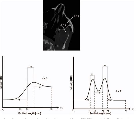 Figure 2 From Model Based Psf And Mtf Estimation And Validation From Skeletal Clinical Ct Images