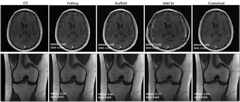 Example Reconstructions Obtained In The Non Iid Client Scenario With Download Scientific