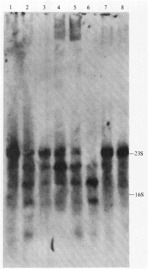 Northern Blot Hybridization Of A 32p Labelled 23s Rrnaspecific Probe To